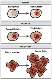 Cancer Stages With Staging Chart - HubPages