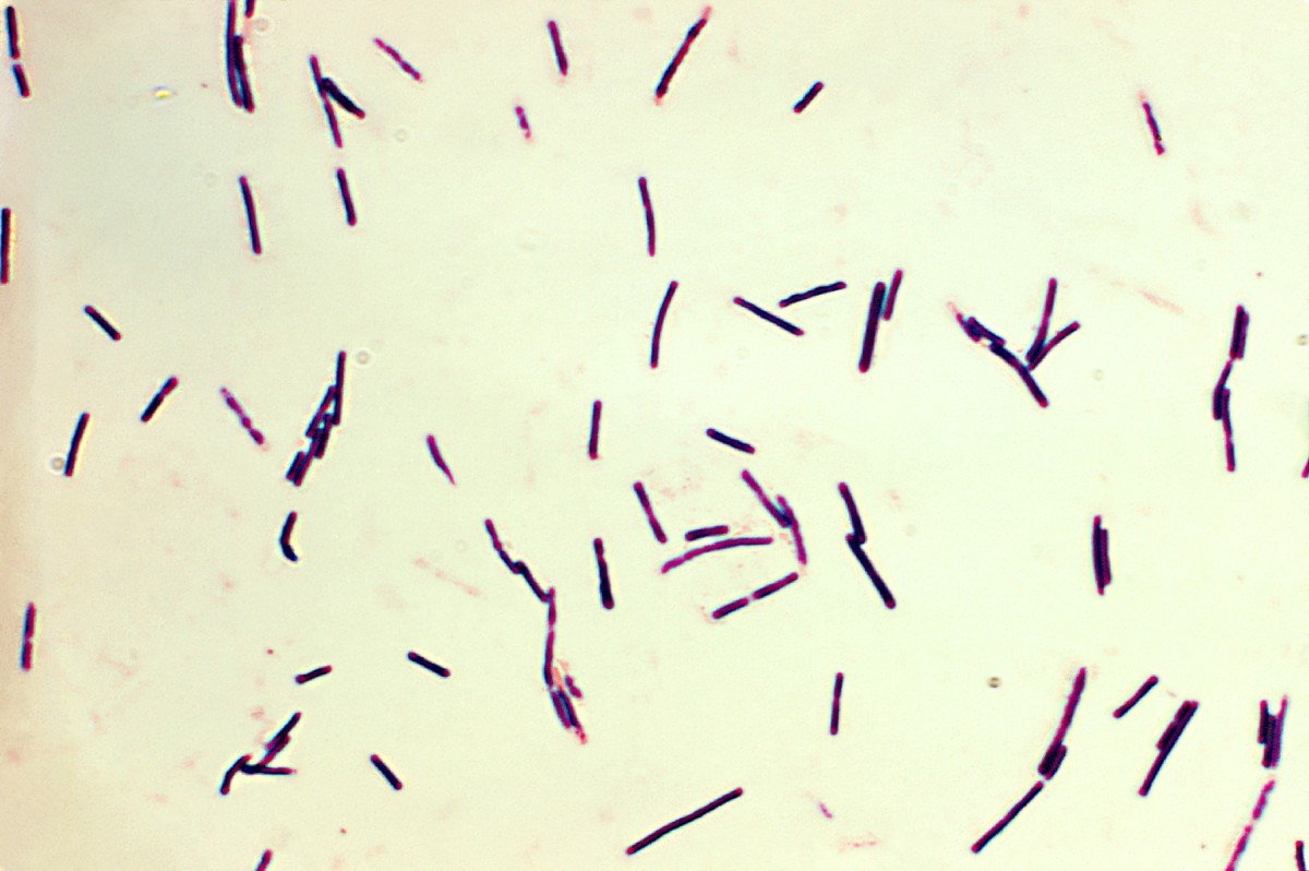 Clostridium Bacteria in Foodborne Illness and Multiple Sclerosis ...