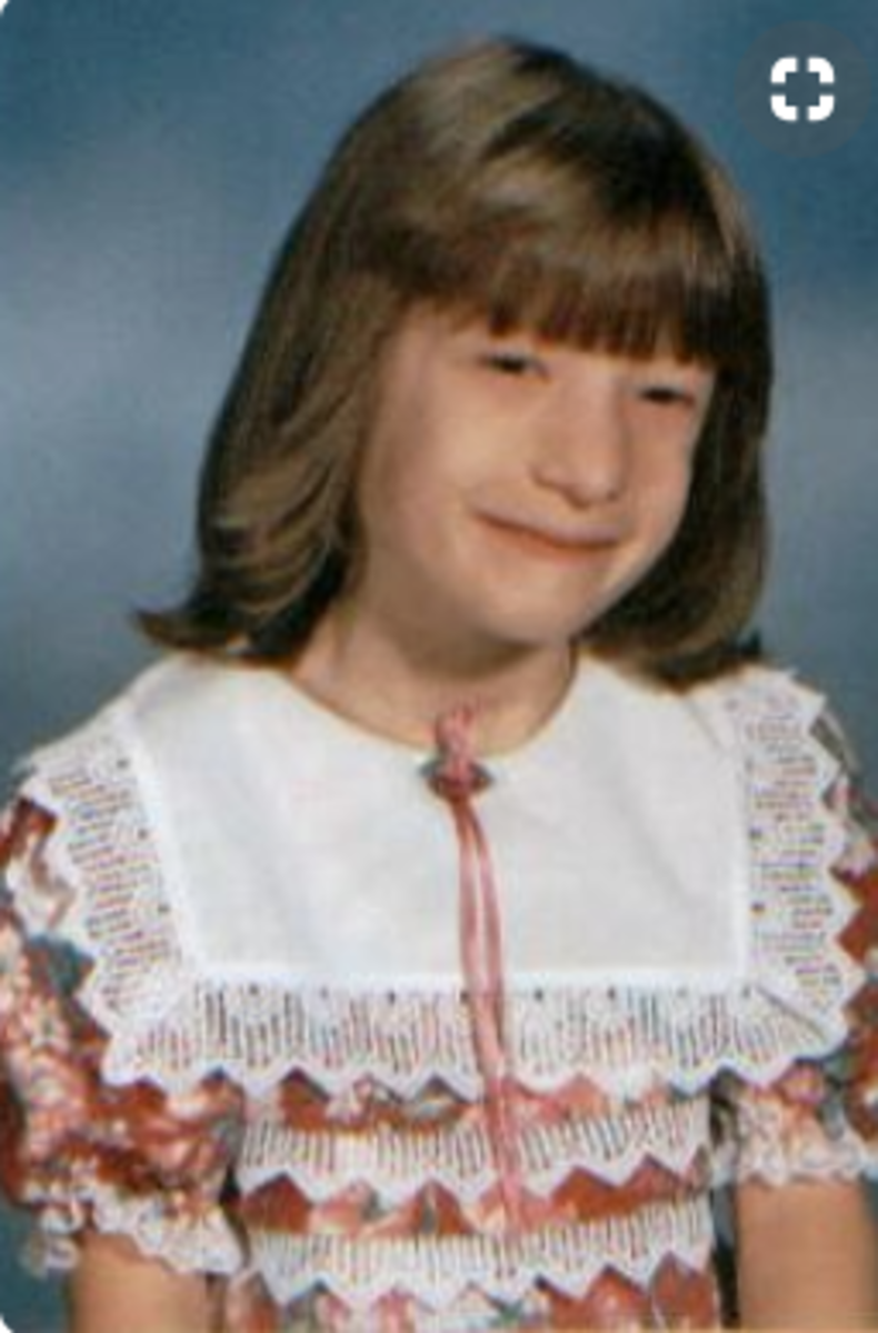 What Is DiGeorge Syndrome? - HubPages