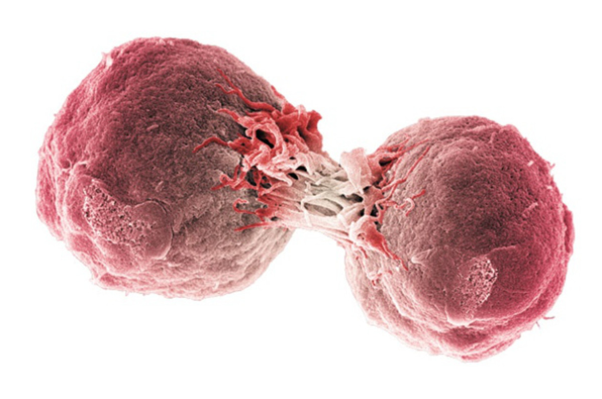 6 Differences Between Cancer Cells and Normal Cells - HubPages