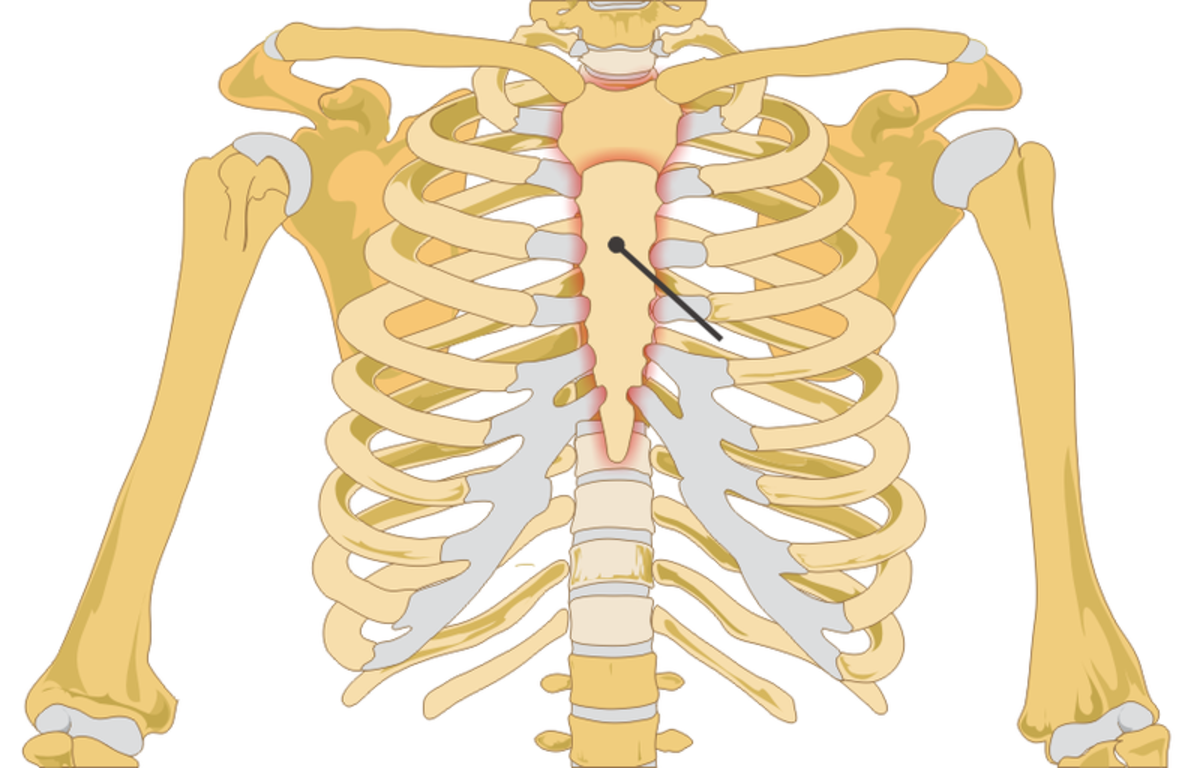 Sternum Popping Everything You Need To Know YouMeMindBody