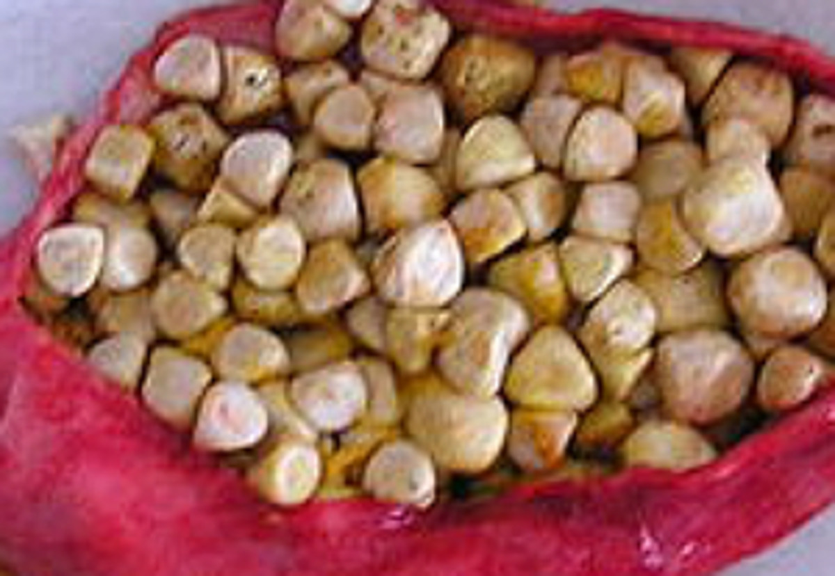 The Causes, Symptoms, and Treatment of Gallstones: My Experience ...