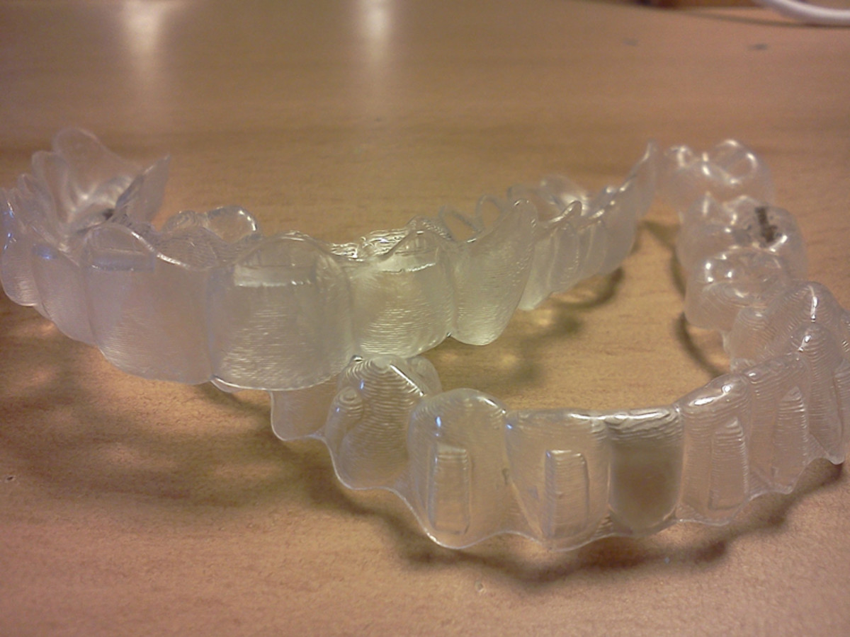 How I Prevent Cavities While Using Invisalign - Patient's Lounge