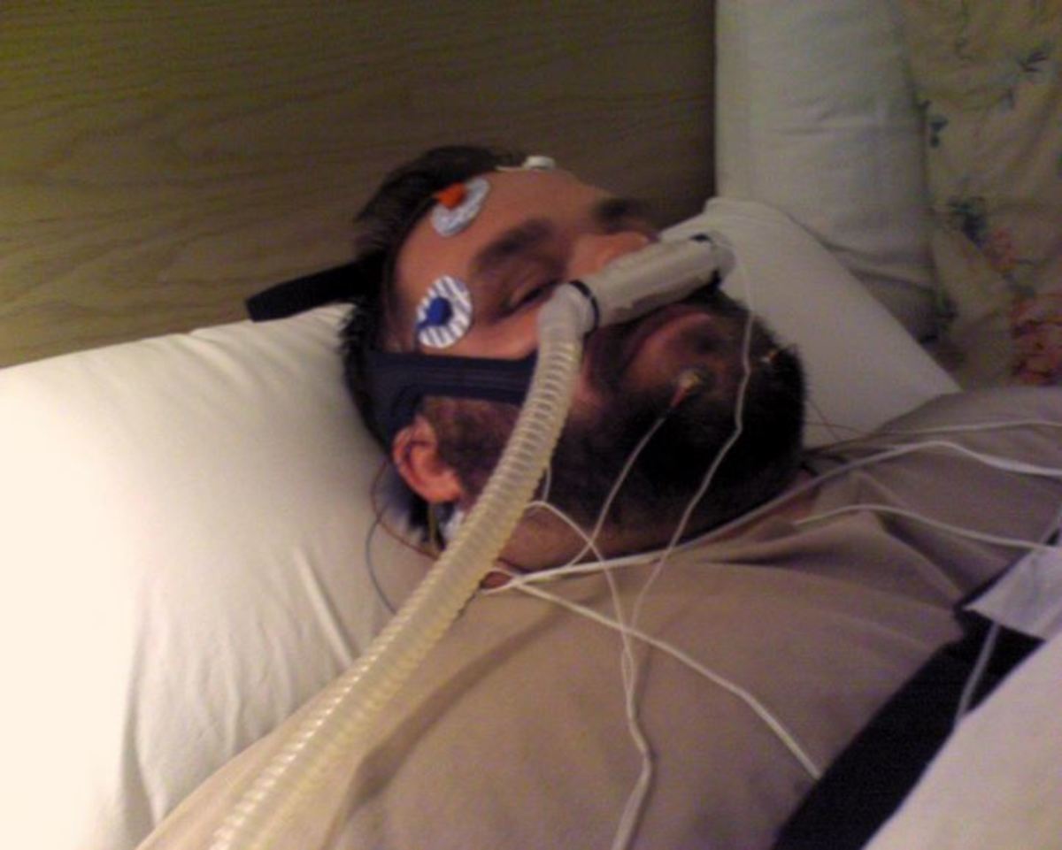My Sleep Study Experience: Overnight Test for Sleep Apnea - HubPages