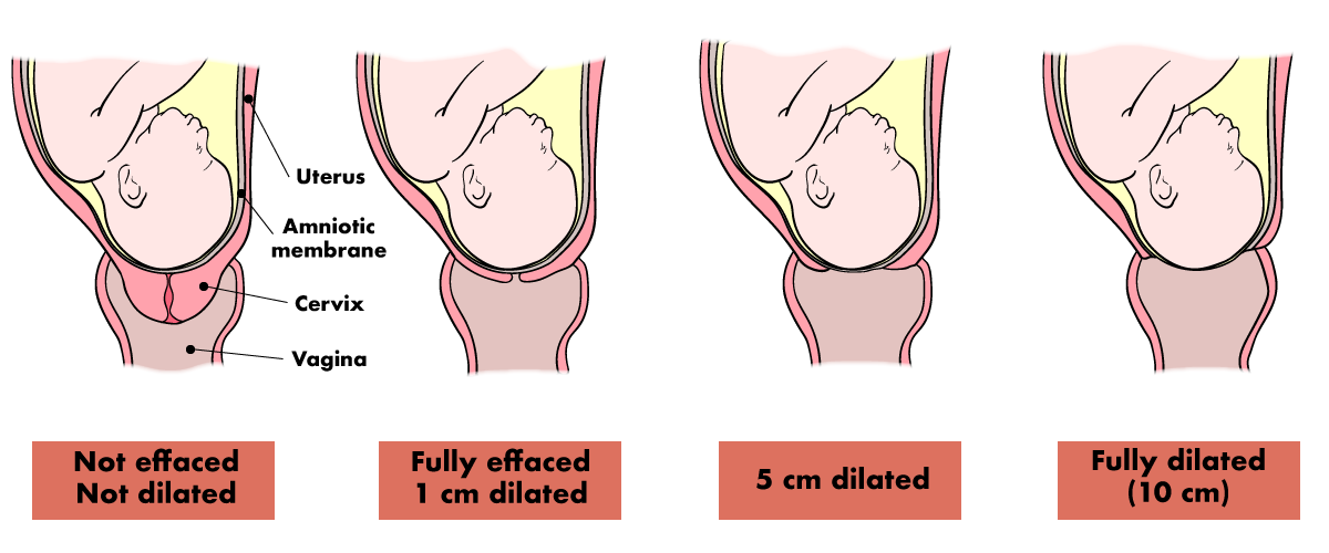 I m Effaced And Dilated When Will I Go Into Labor WeHaveKids