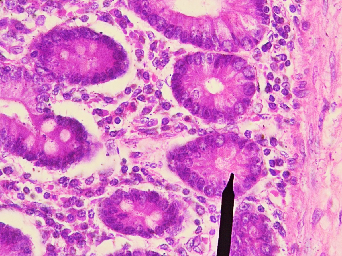 Paneth Cells and Their Association With Crohn's Disease - Owlcation