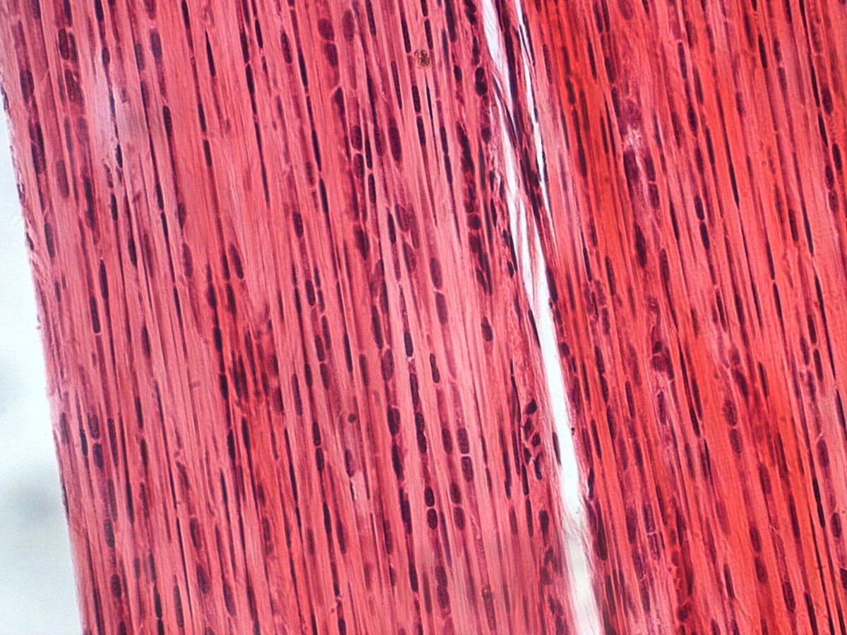 Interstitial Fluid And The Interstitium Formation And Function Owlcation
