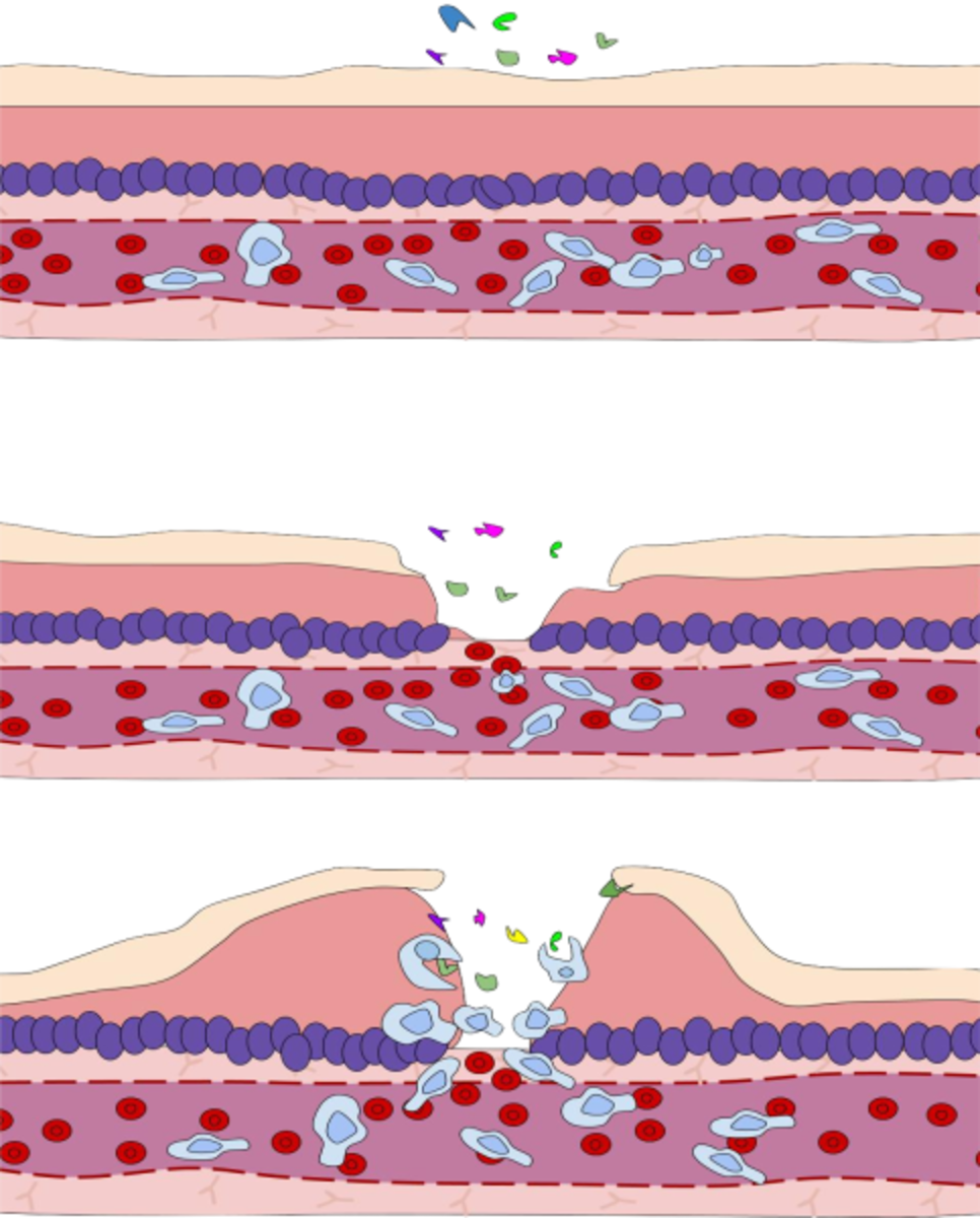 An Introduction to Your Immune System - HubPages