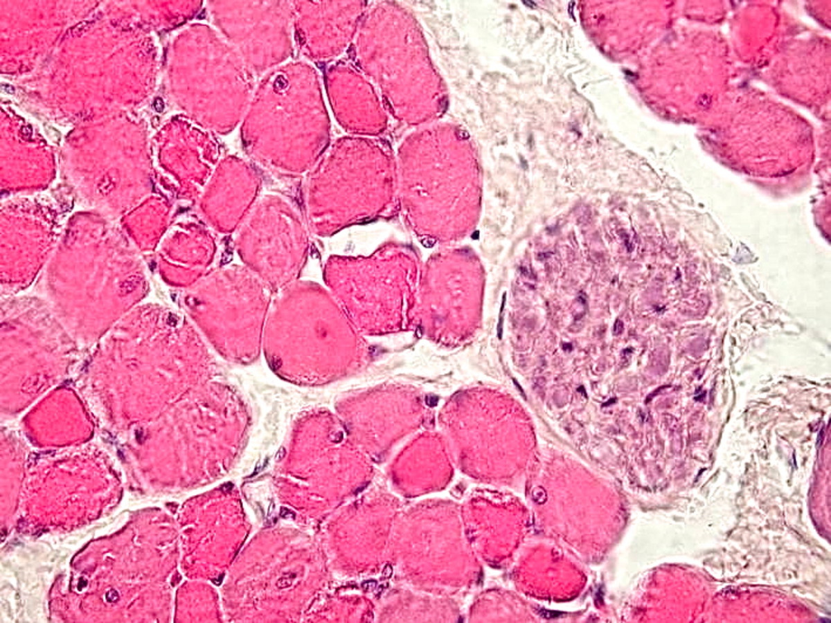 Protein Functions in the Human Body and in Our Cells - Owlcation