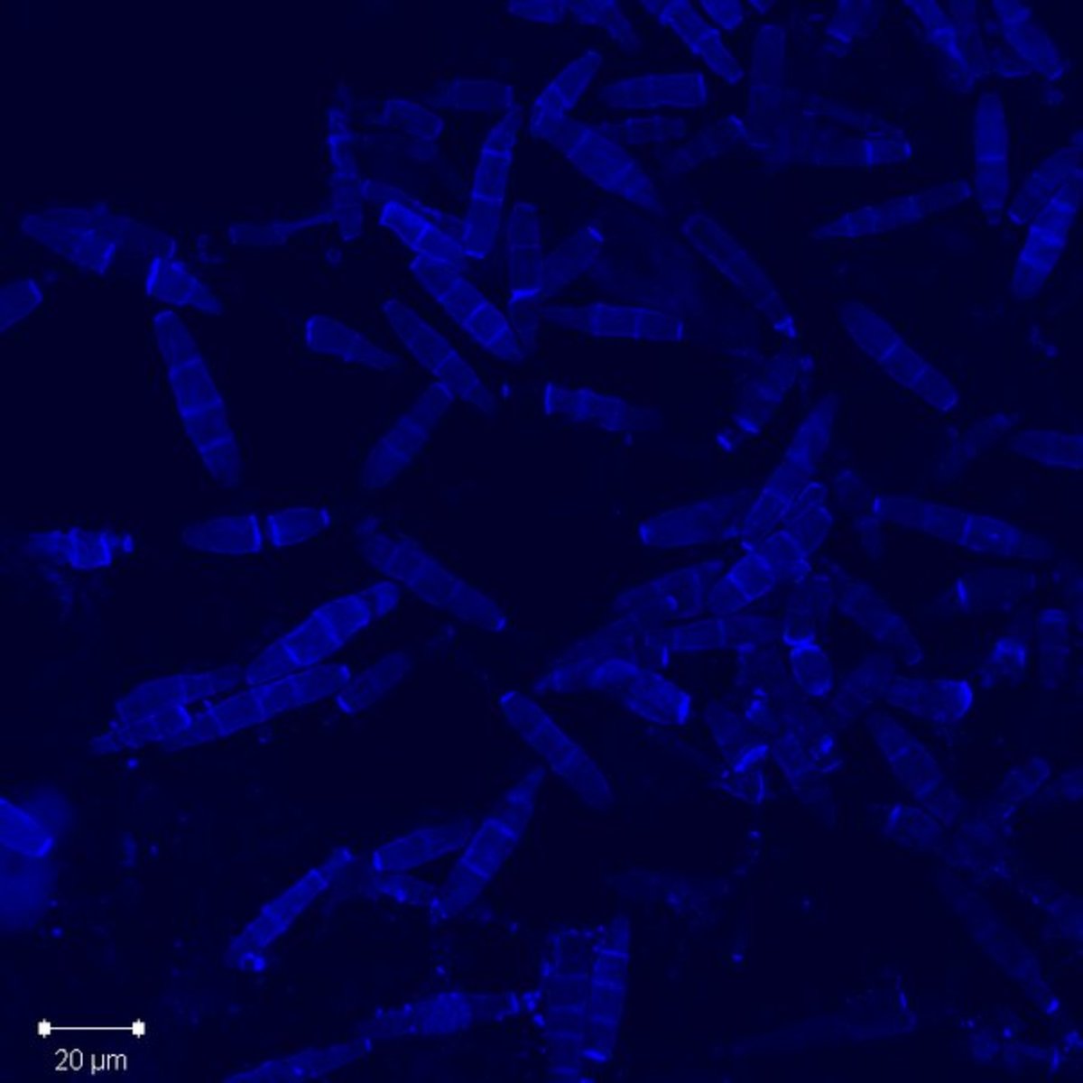 A Micrscopic Look at Ringworm - Owlcation