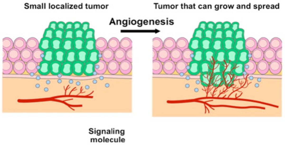 A List of Anti-Angiogenic Foods for a Cancer-Fighting Diet - HubPages