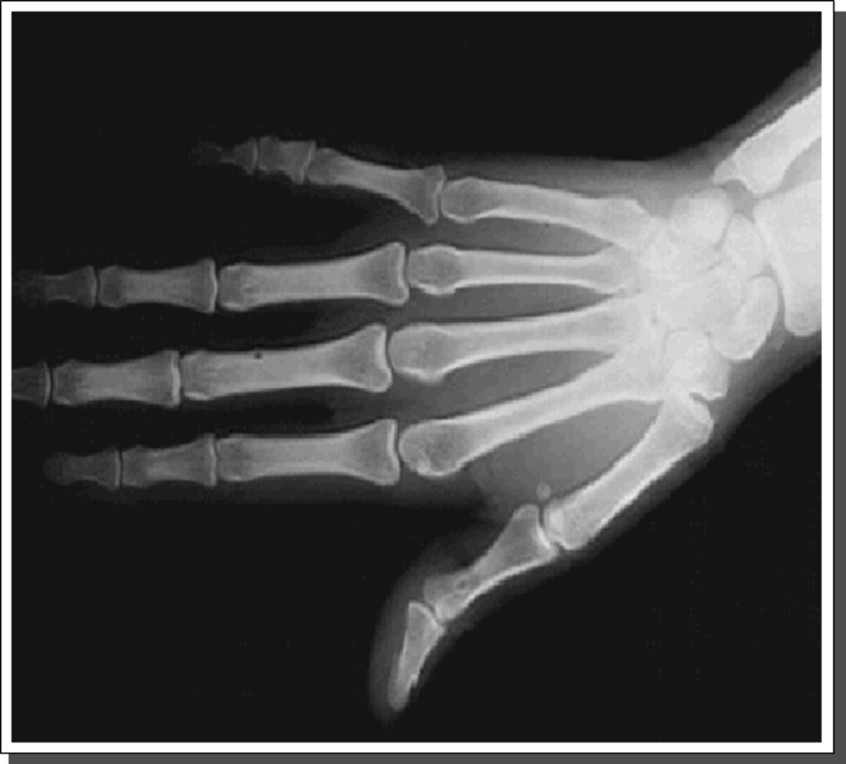 Gnosis and Diagnosis - LetterPile