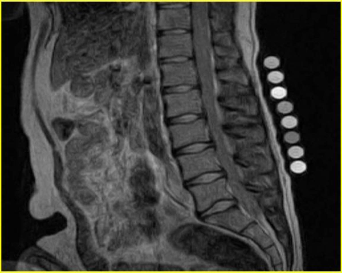 Sitting In A Tilted Backward Position Could Be Better For Your Back ...