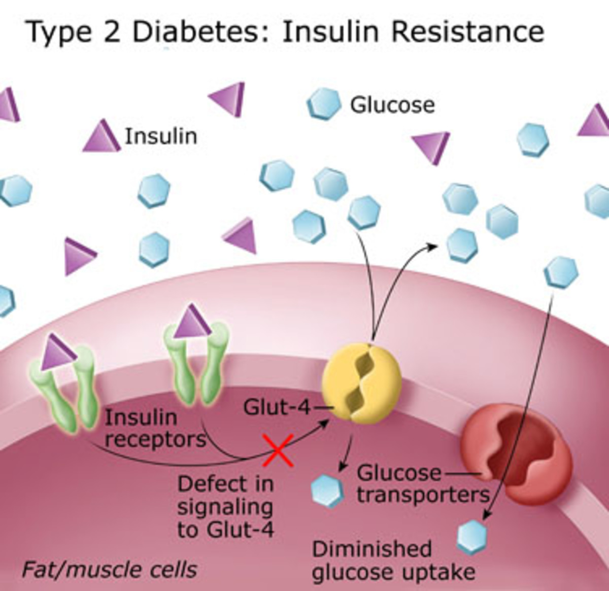 What is Type 2 Diabetes Mellitus or Non-Insulin Dependent Diabetes ...