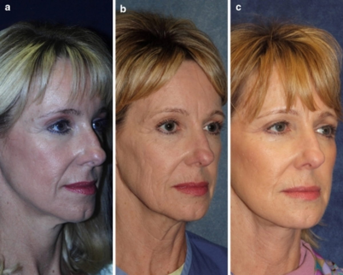 Why Do We Have Different Personalities Hubpages