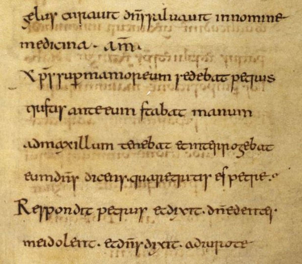 Tooth Worms and Weird Medieval Charms to Cure Toothache - HubPages