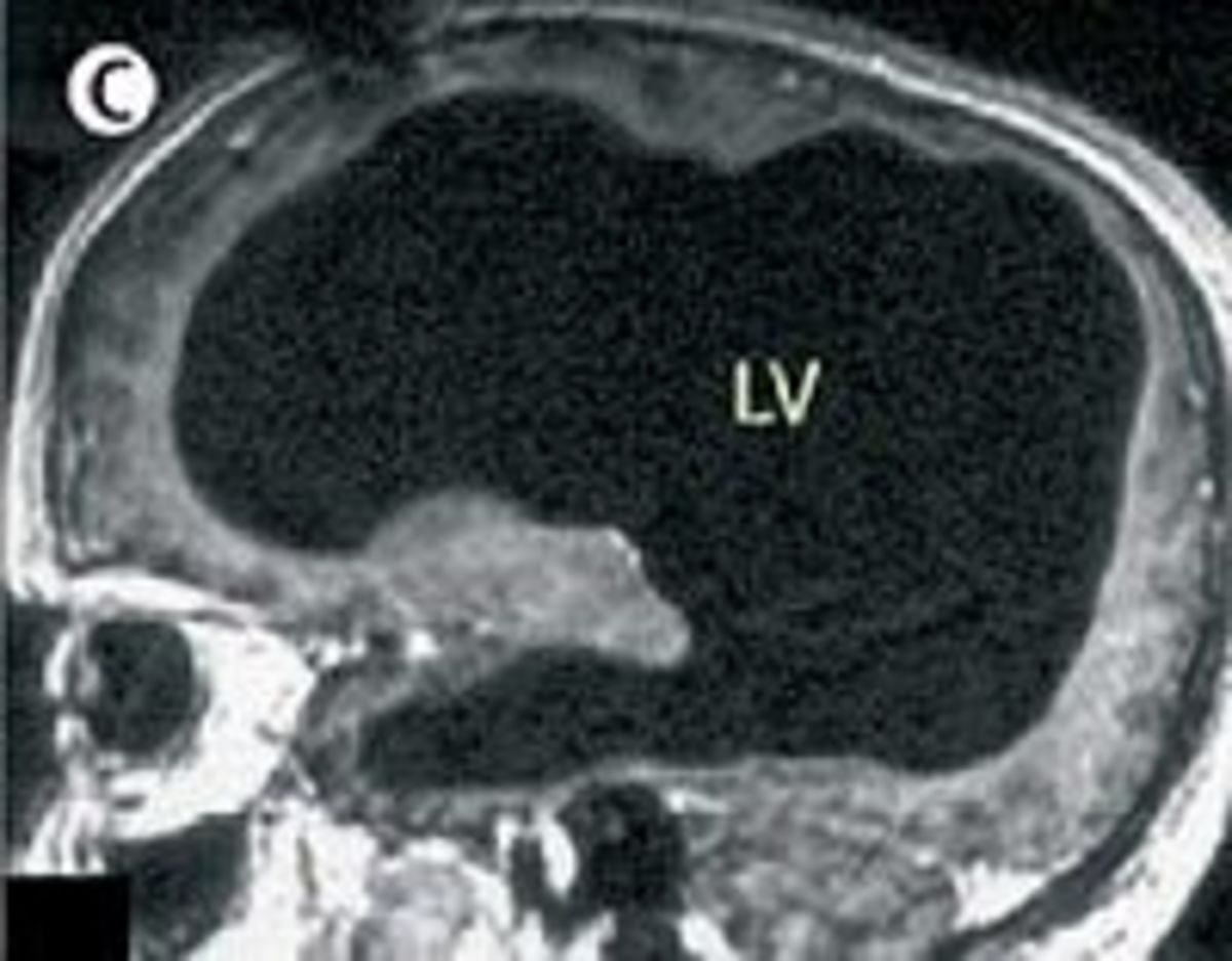 Language is Learned - HubPages