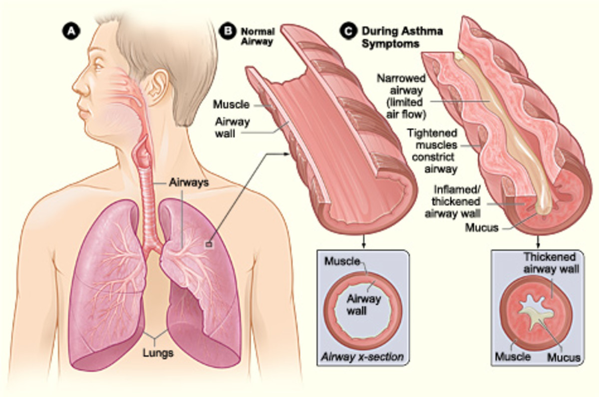 Airway Resistance and Flow Dynamics - HubPages