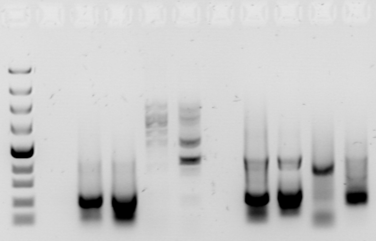 Molecular Biology Laboratory Techniques - HubPages Molecular Biology Laboratory Techniques - HubPages