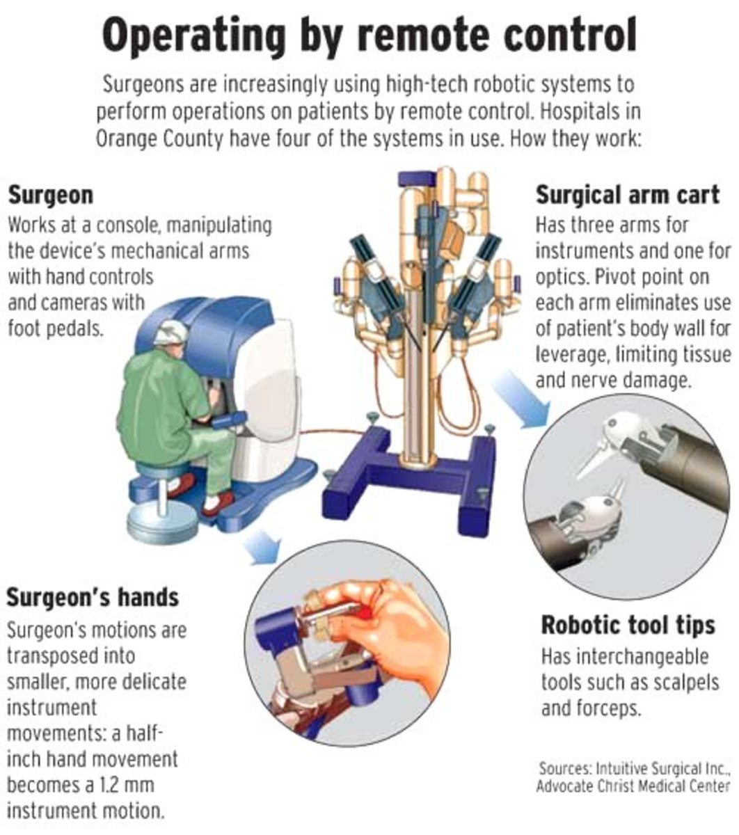 Robotic Surgery: The Technology, Benefits and Risks - HubPages