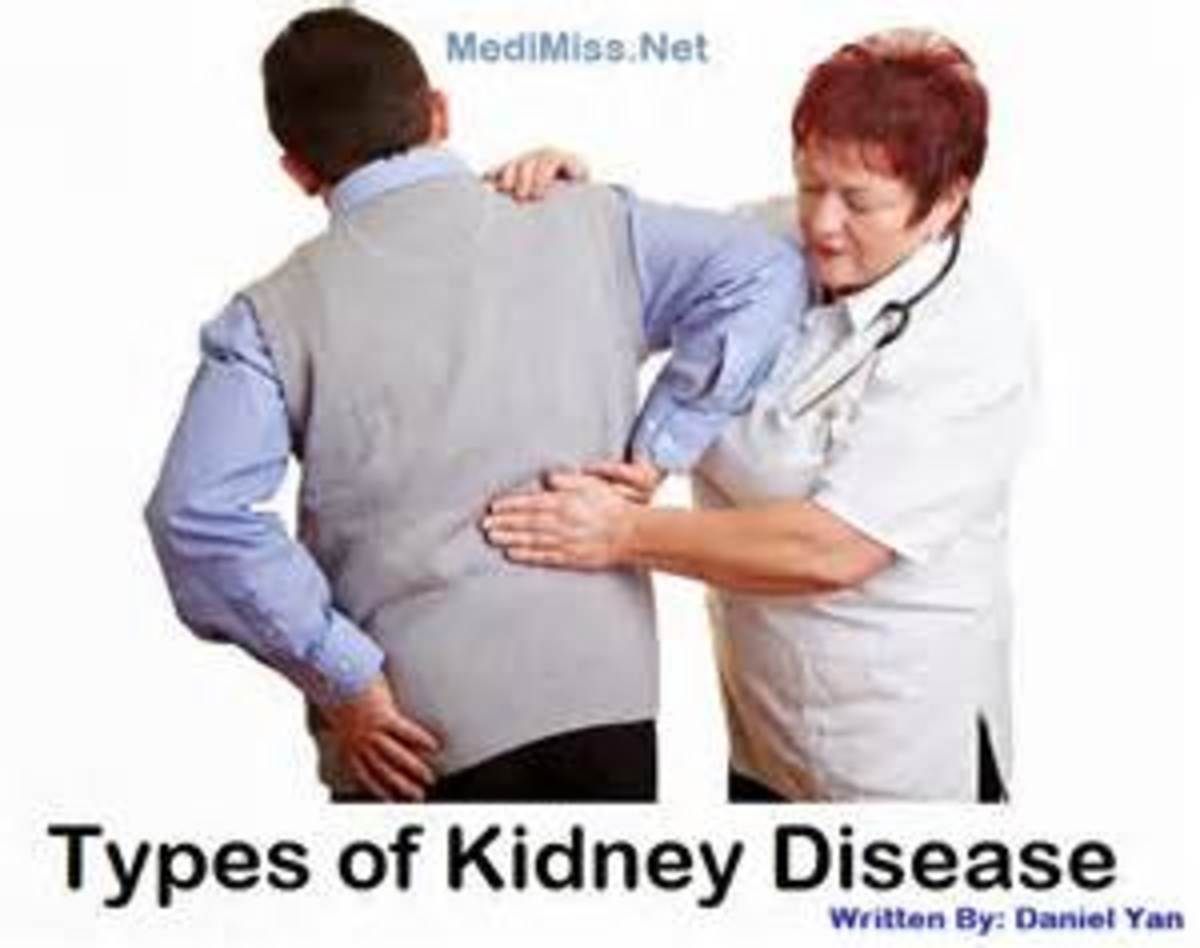 17 Signs Of Chronic Kidney Disease - HubPages