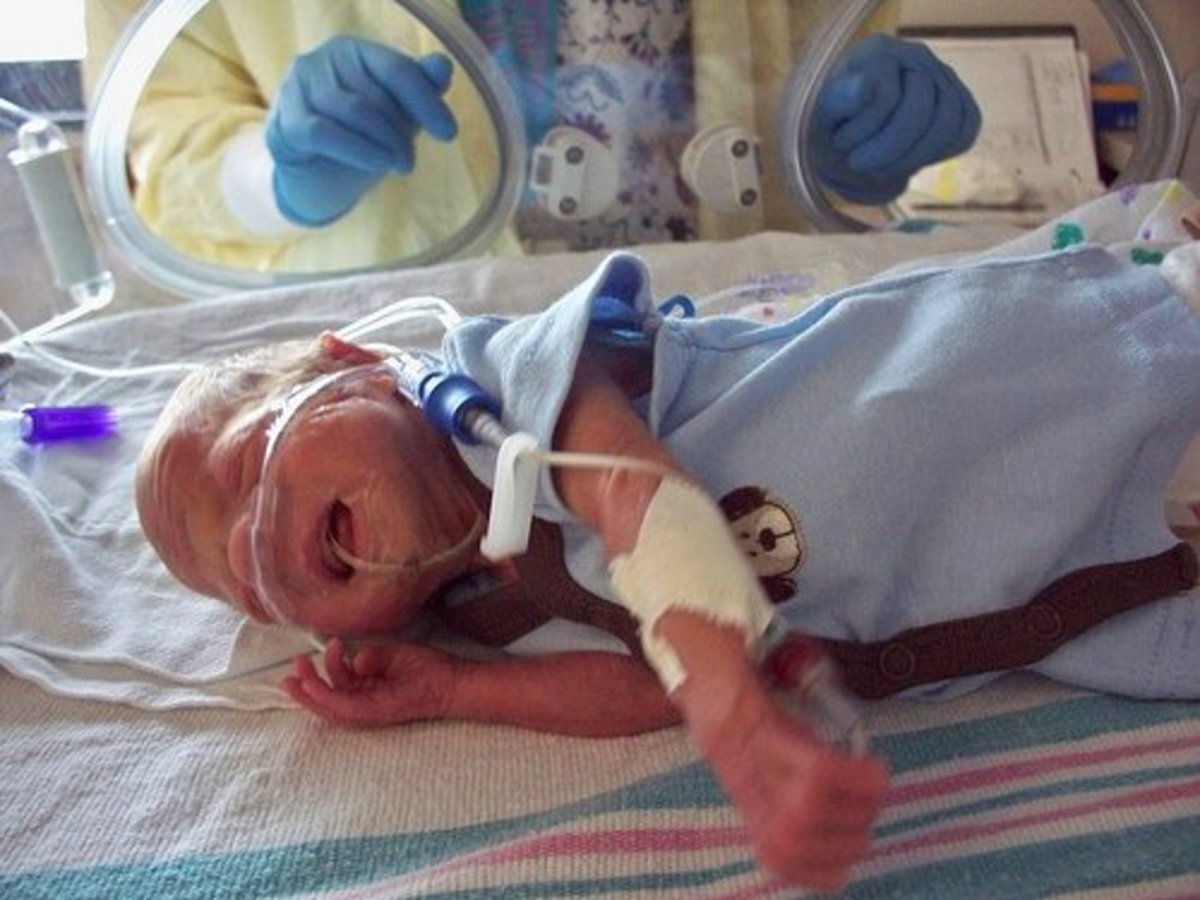Interacting With Your Premature Infant: Identifying Overstimulation ...