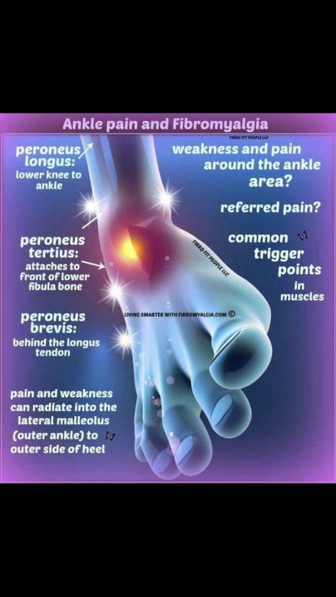 The Invisible Pain. - HubPages