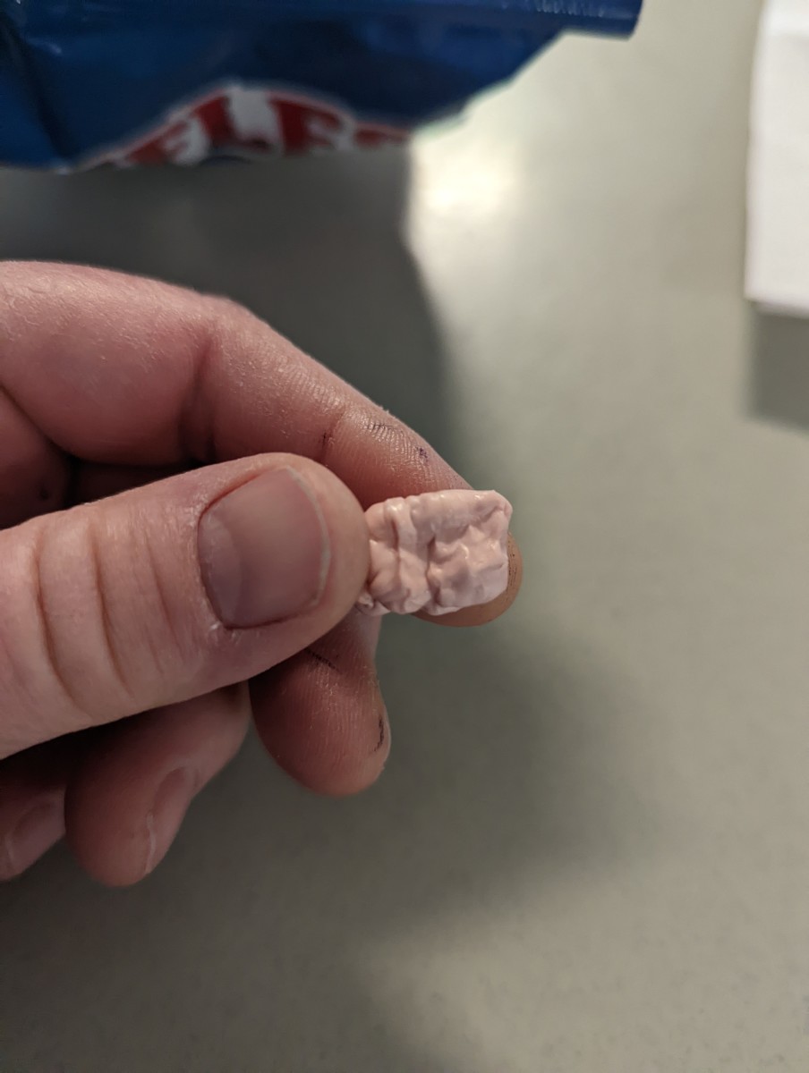 Chewing Gum Dance in the Mouth - HubPages