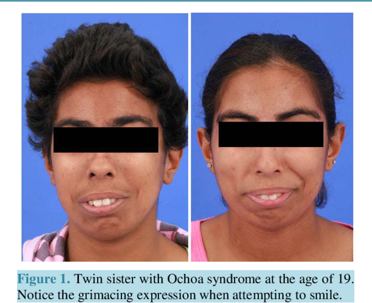 The Chronicles of Rarity: Top 20 Uncovering History's Rarest Diseases ...