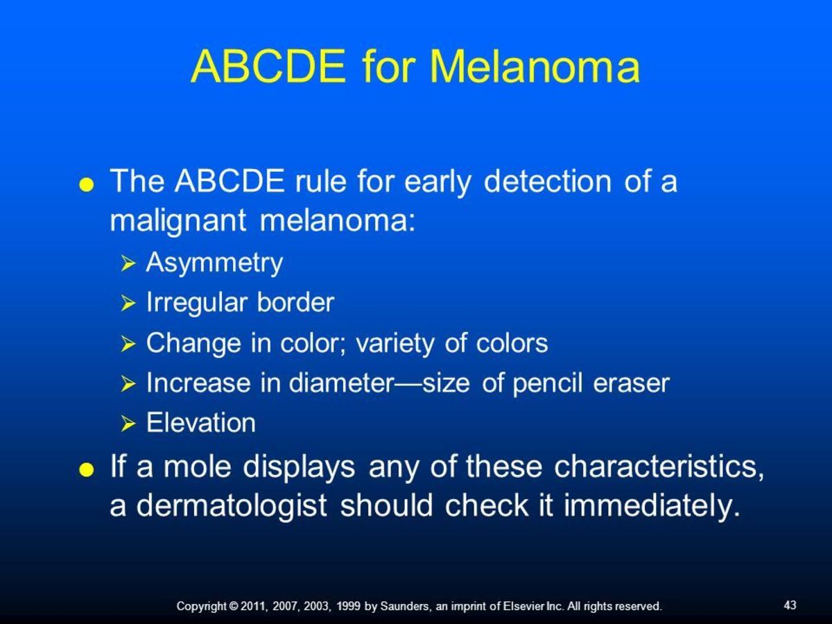 Age Spots Are Part Of Aging - HubPages