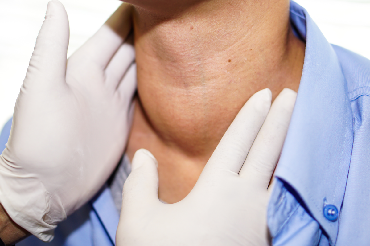 Causes and Treatments of Lumps: Neck, Armpit, Wrist, & More - HubPages