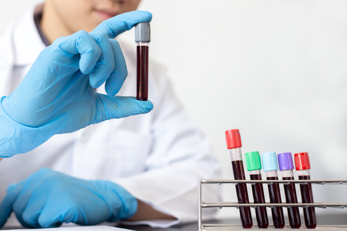 The Top 10 'Rare' Blood Types: A Guide for Transfusion Services ...