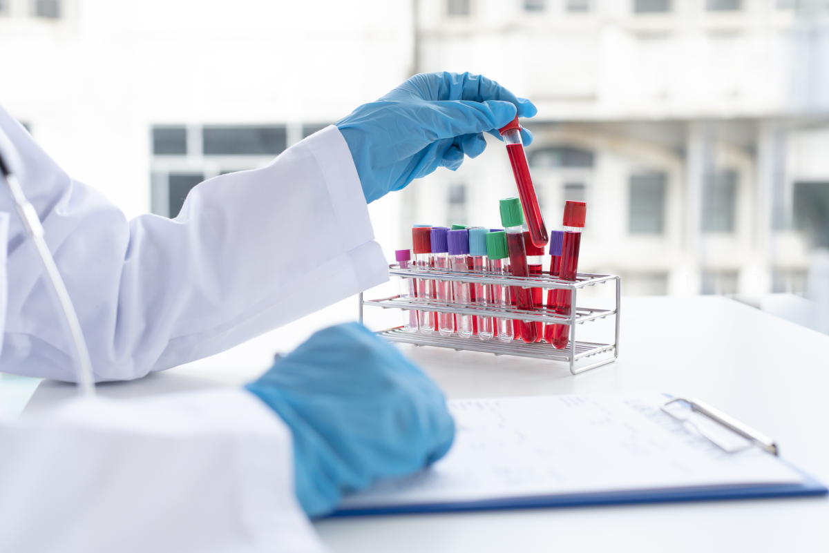 The Top 10 'Rare' Blood Types: A Guide for Transfusion Services ...