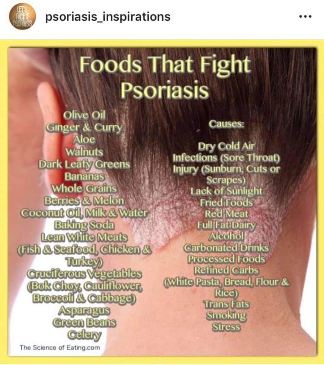 Healing my Psoriasis and Psoriatic Arthritis naturally at home with ...