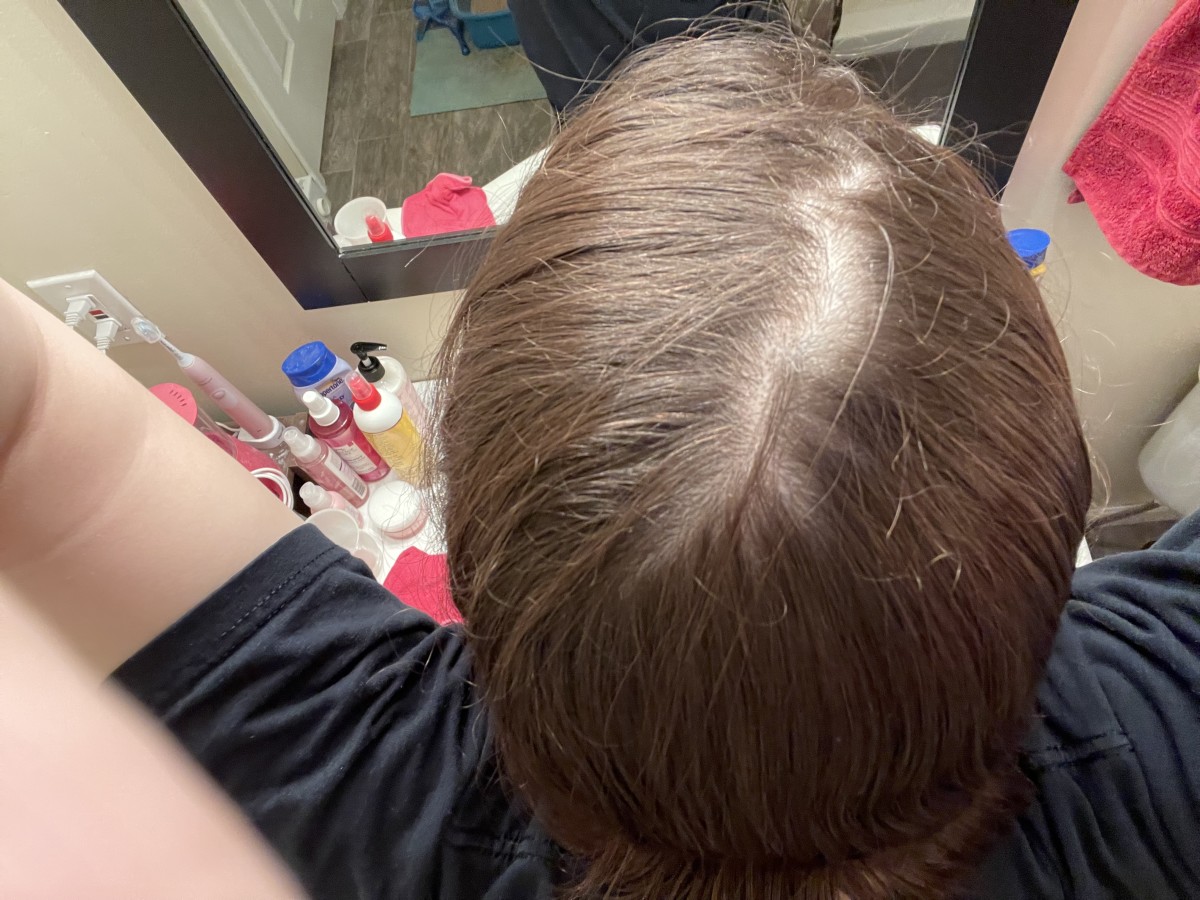 My Experience Using the Paxman Cold Cap During Chemo - HubPages