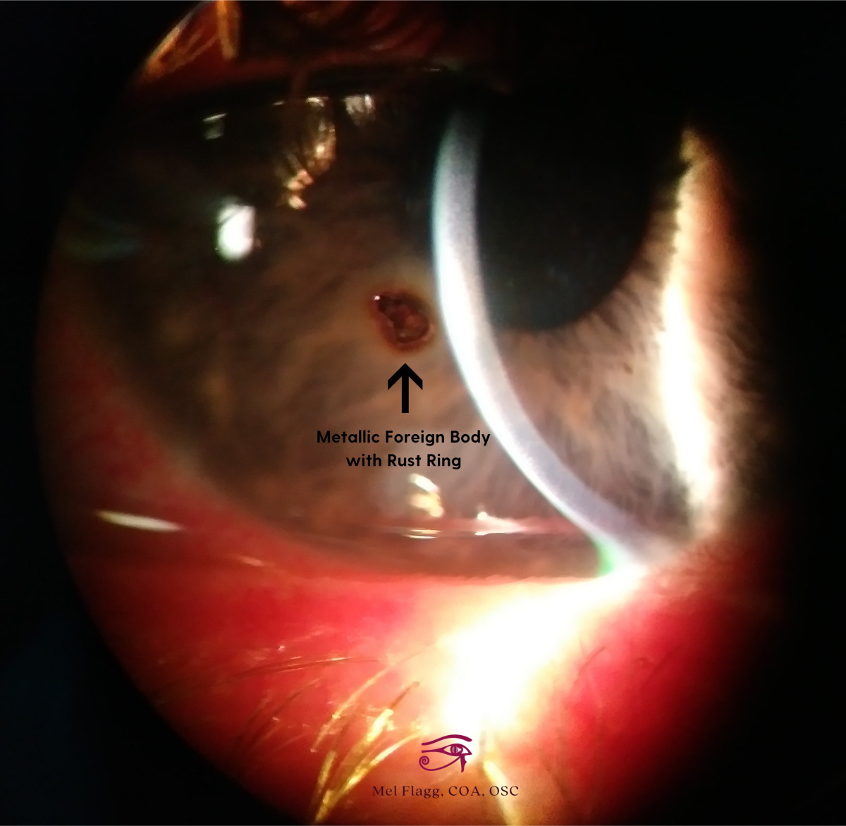 Emergency Eye Injury Treatment (Plus Easy Prevention Tips) - YouMeMindBody