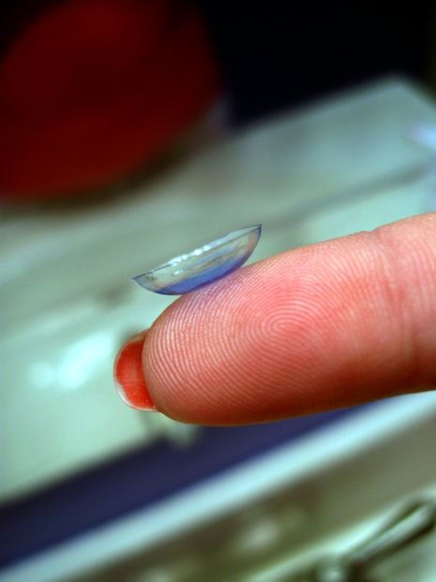 My PRK Laser Corrective Eye Surgery Experience - HubPages