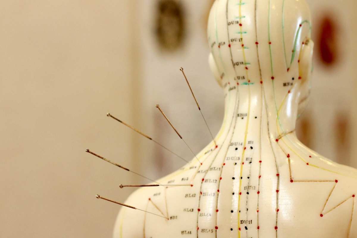When Acupuncture is Necessary in Wound Management - HubPages