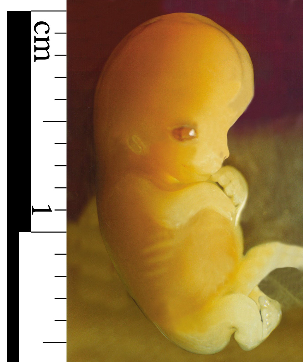 How Would Natural Law Apply to Embryo Research? - Owlcation