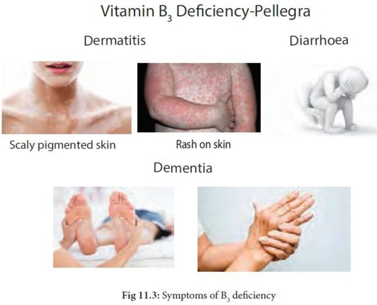 All You Need to Know About the Mysterious Vitamin- B Complex - HubPages