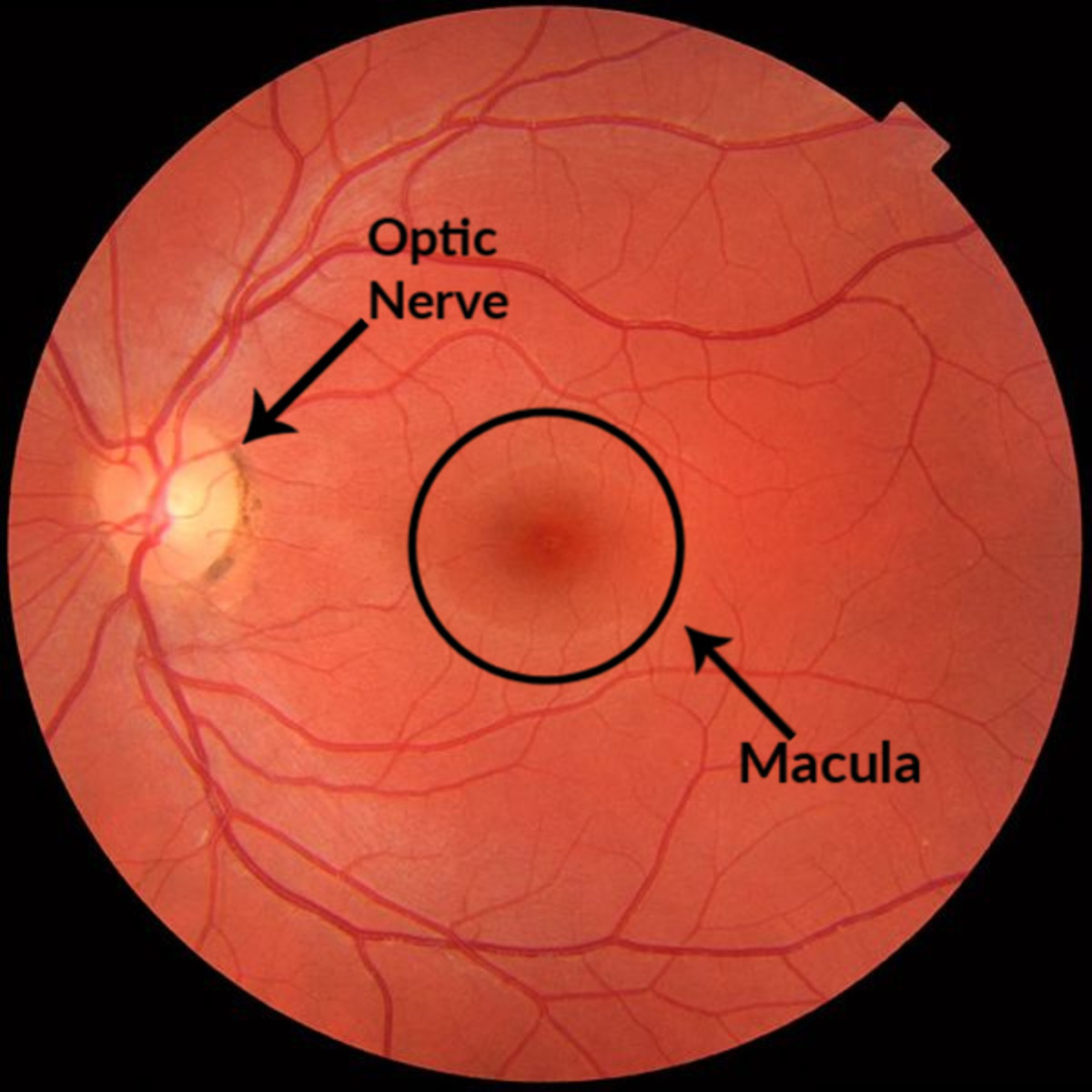 Definition of Retina: Anatomy, Function, and Diseases - YouMeMindBody
