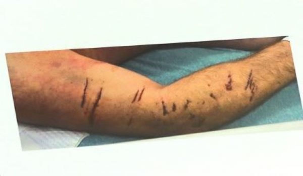 Did Karen Read murder her boyfriend John O'Keefe? This is my opinion ...