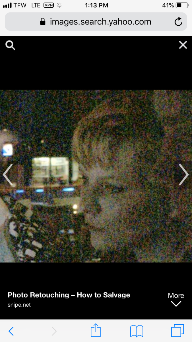 My Realization That I Have Visual Snow Symptoms and It’s Effects on My ...