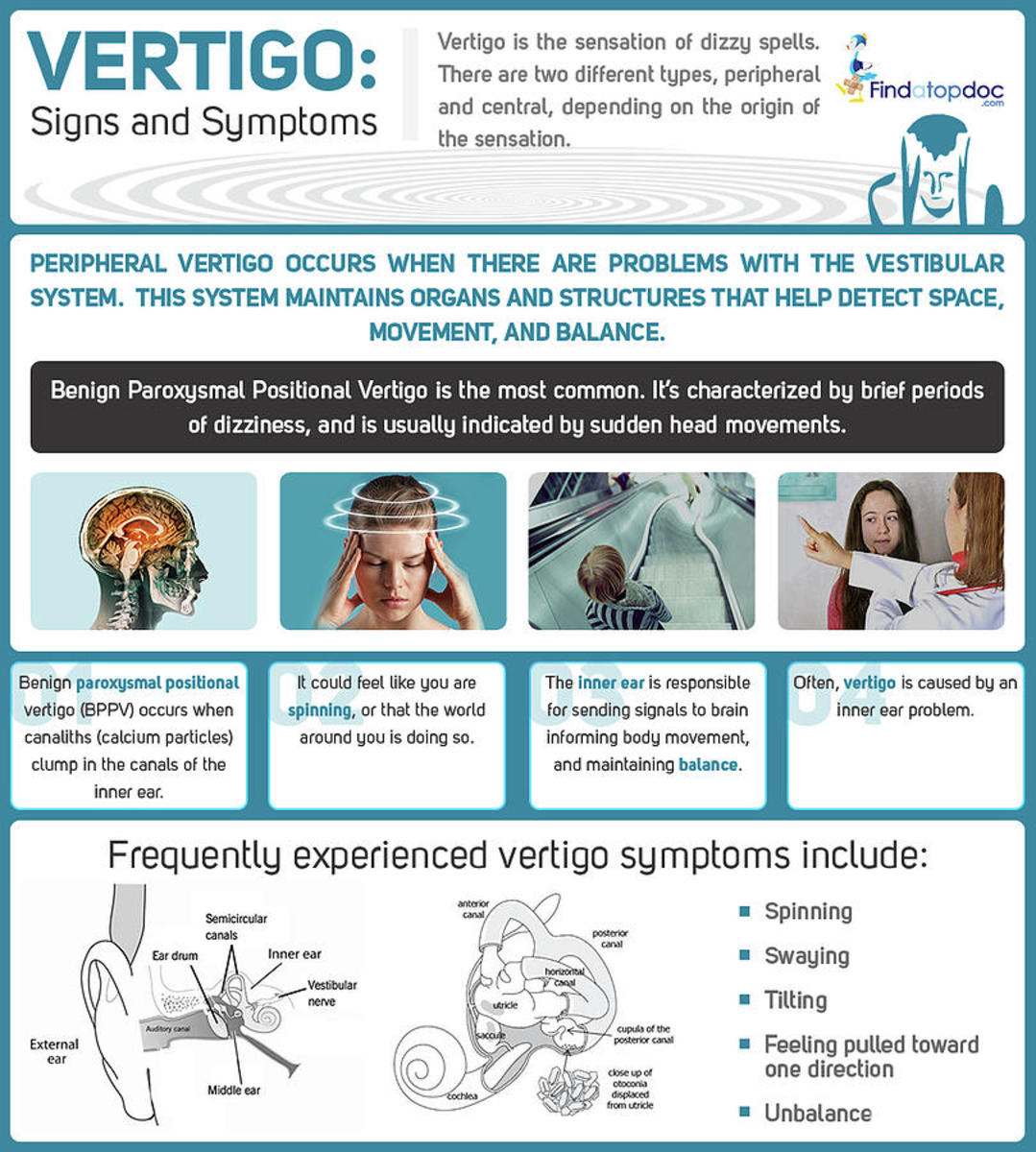 Vertigo is a Spinning Experience You Don't Ever Want To Experience ...
