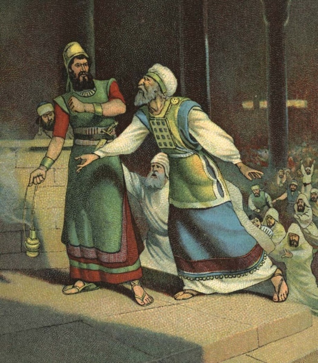 Why he Died a Leper - HubPages