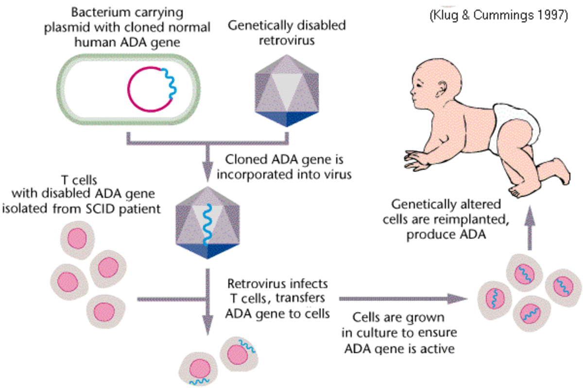 Severe Combined Immunodeficiency (SCID) - HubPages