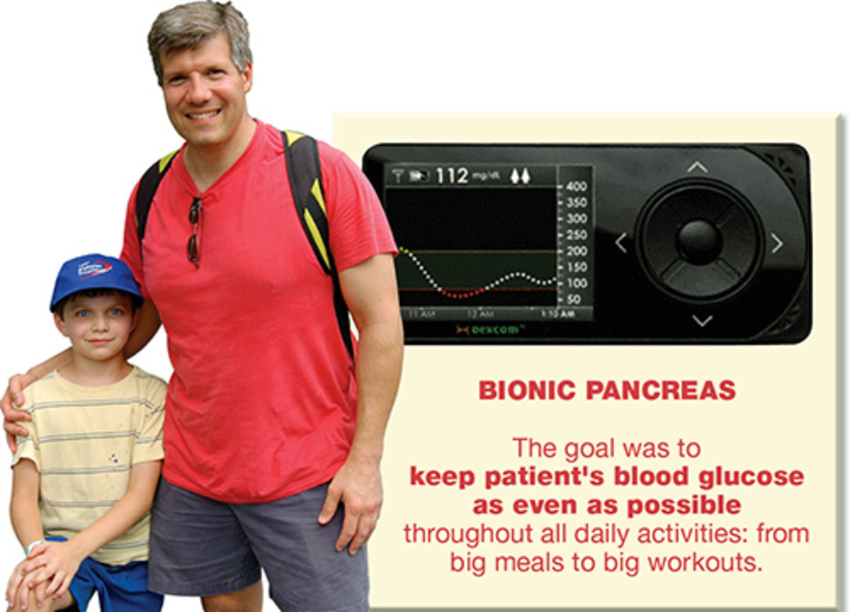 Type 1 Diabetes: Innovative Treatment, the Bionic Pancreas Brings Hope ...