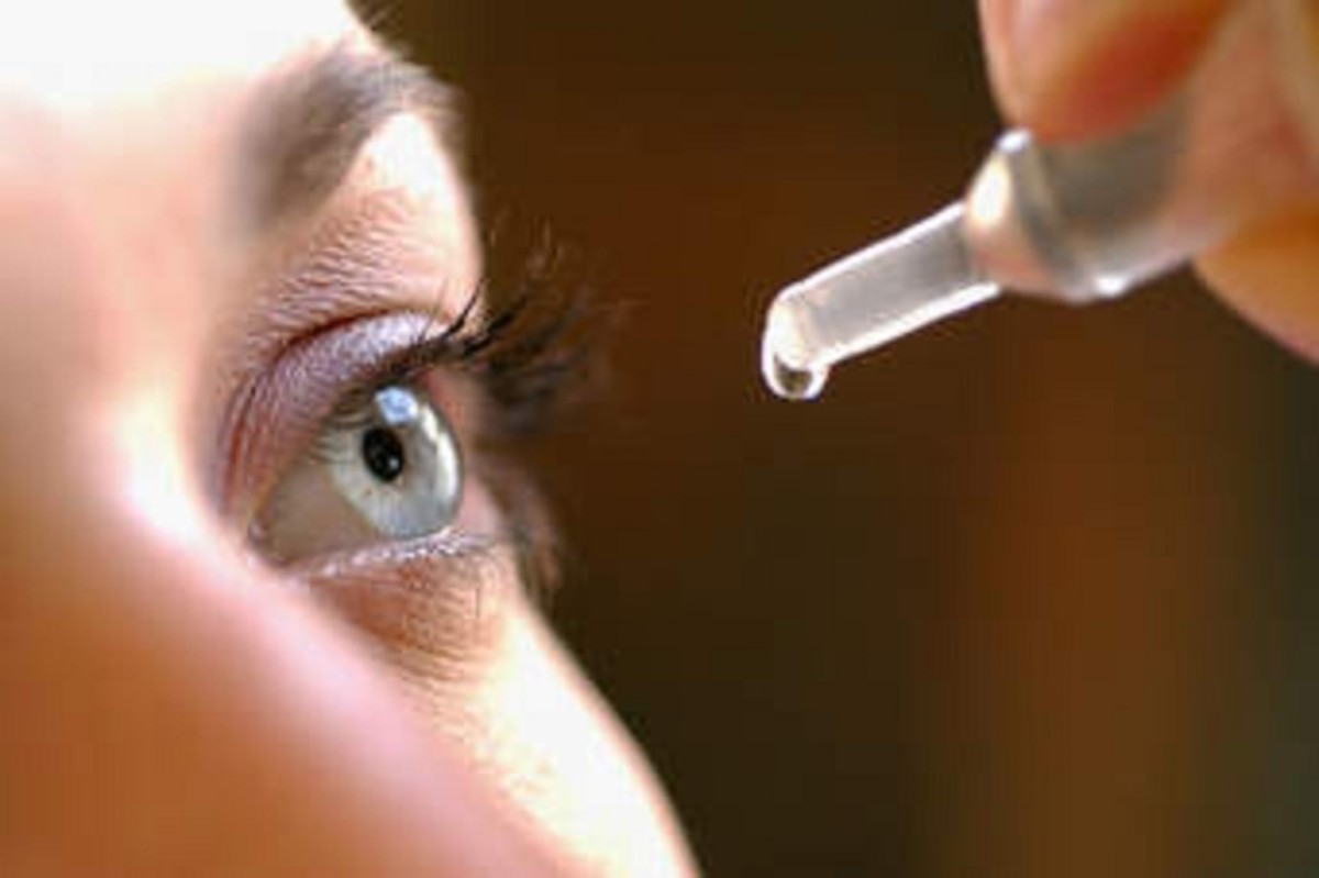 Adeno Viral Kerato Conjunctivitis - HubPages