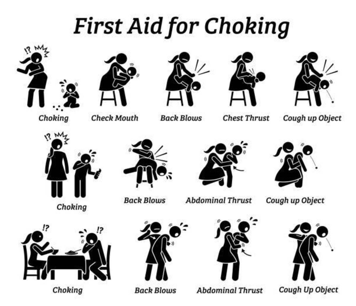 First Aid for Choking and Prevention - HubPages